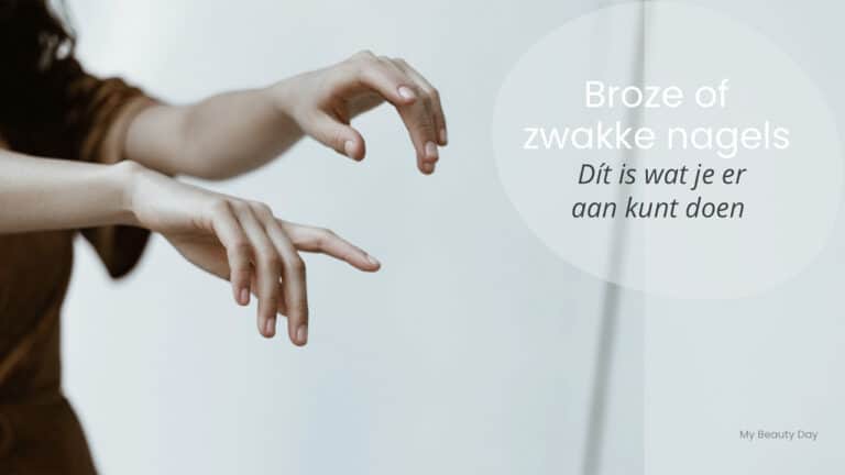 Last van broze of zwakke nagels? Dit kun je eraan doen